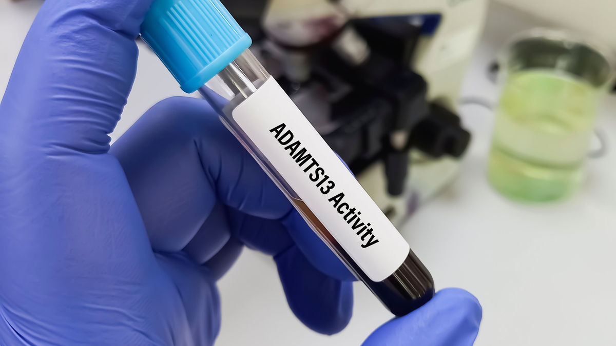 Kognitive Beeinträchtigungen und Depressionen bei TTP