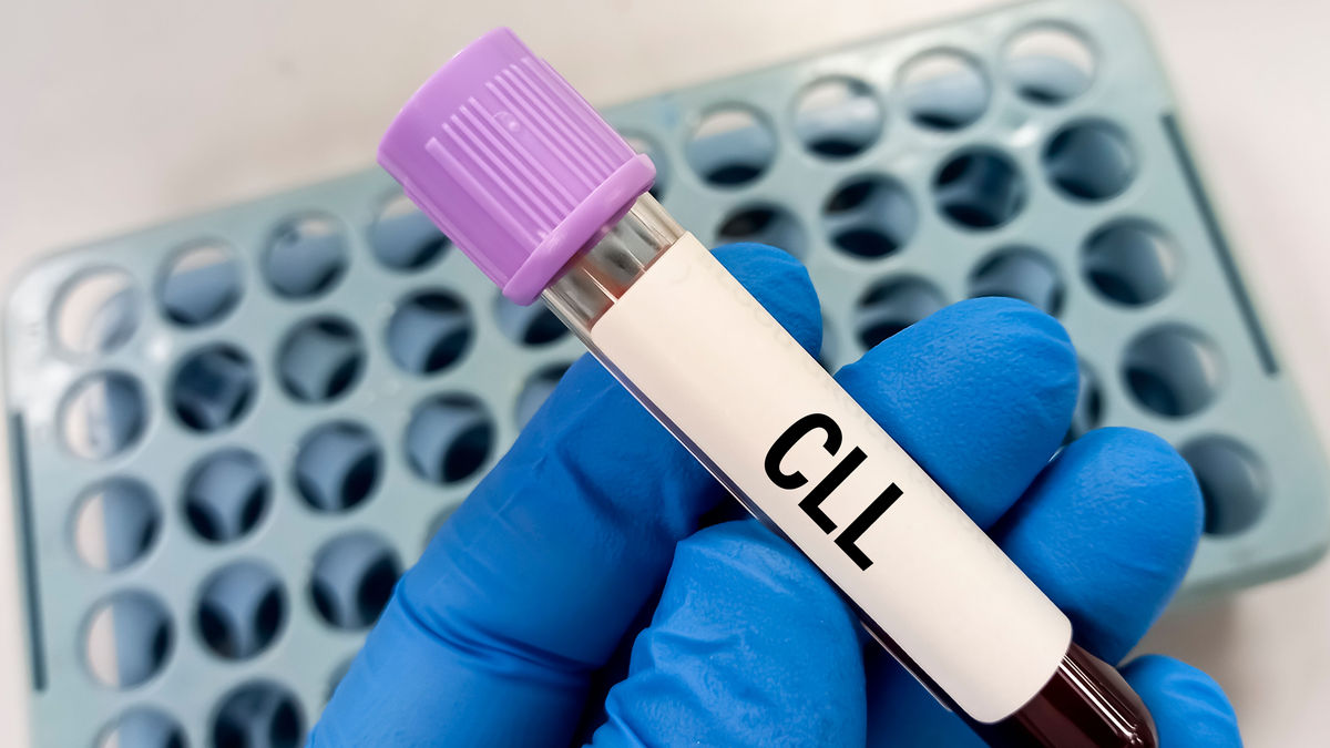 Pirtobrutinib bei vorbehandelter CLL zugelassen
